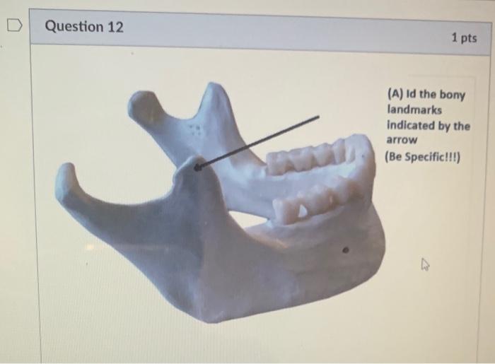 Solved (A) Id the Bony Landmark labeled "1" in Green. (B) | Chegg.com