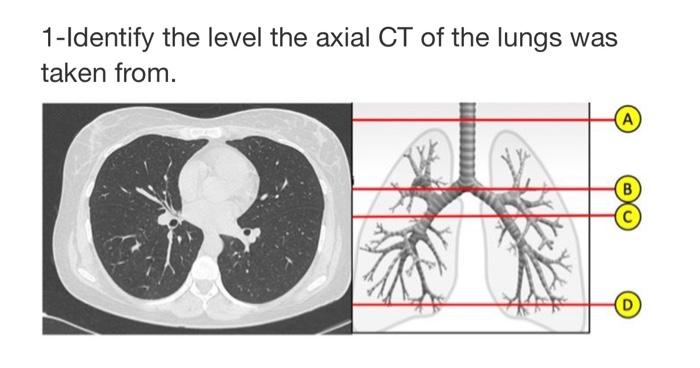 Solved 1-Identify the level the axial CT of the lungs was | Chegg.com