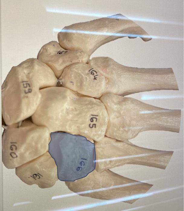 Solved Lunate Capitate Scaphoid Trapezoid Trapezium | Chegg.com