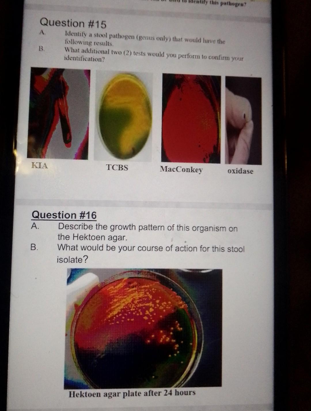 Solved tify this pathogen? Question #15 A Identify a stool | Chegg.com