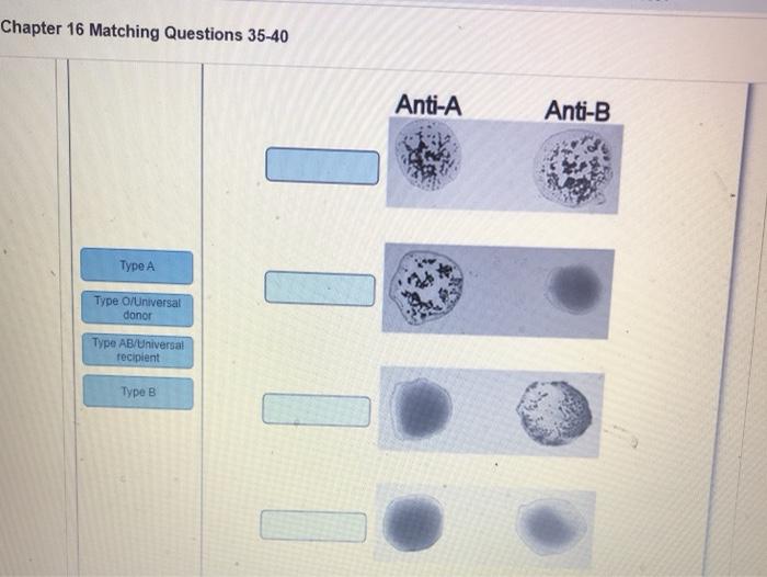 Solved Chapter 16 Matching Questions 35-40 Anti-A Anti-B | Chegg.com