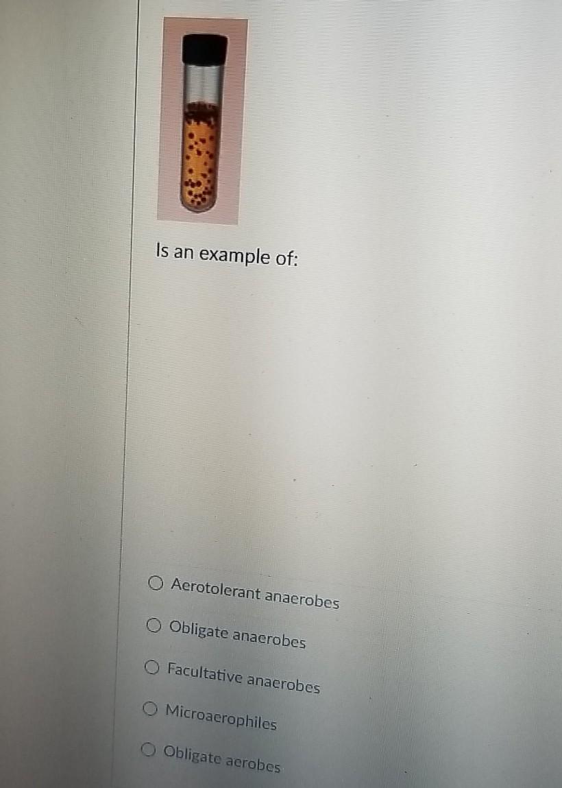 Solved Is an example of: Aerotolerant anaerobes Obligate | Chegg.com