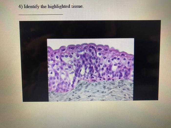 Solved Cells and Tissue Identification 1) Identify the | Chegg.com