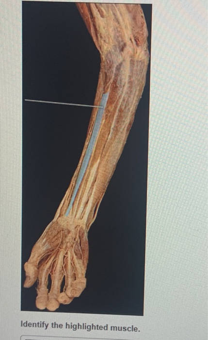 Solved Identify the highlighted muscle. | Chegg.com