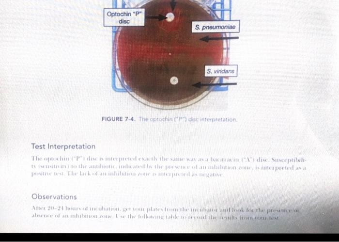 Solved The Bacitracin or "A" Disc The bacitracin ("A") disc | Chegg.com