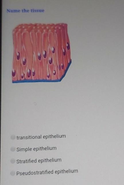 Solved Name the tissue -- transitional epithelium Simple | Chegg.com