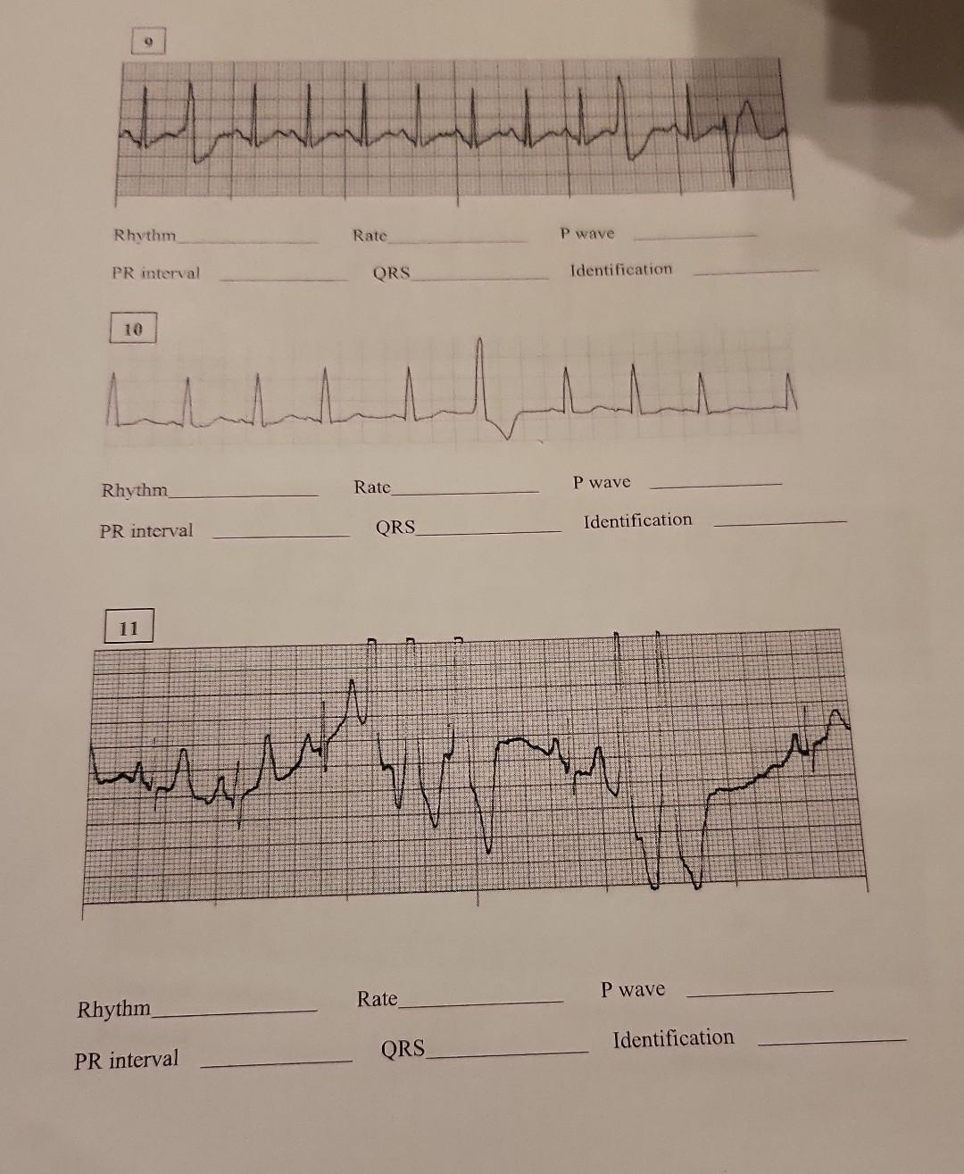 Solved Rhythm Rate P wave PR interval QRS Identification | Chegg.com