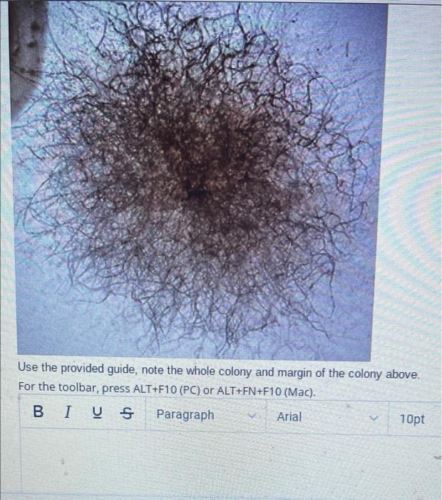 Solved QUESTION 14 Whole colony Round Imegular Spindle | Chegg.com