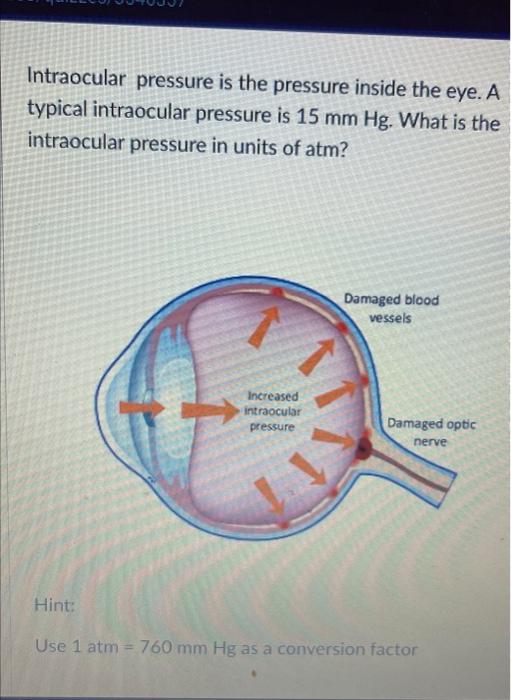 Solved Intraocular pressure is the pressure inside the eye. | Chegg.com