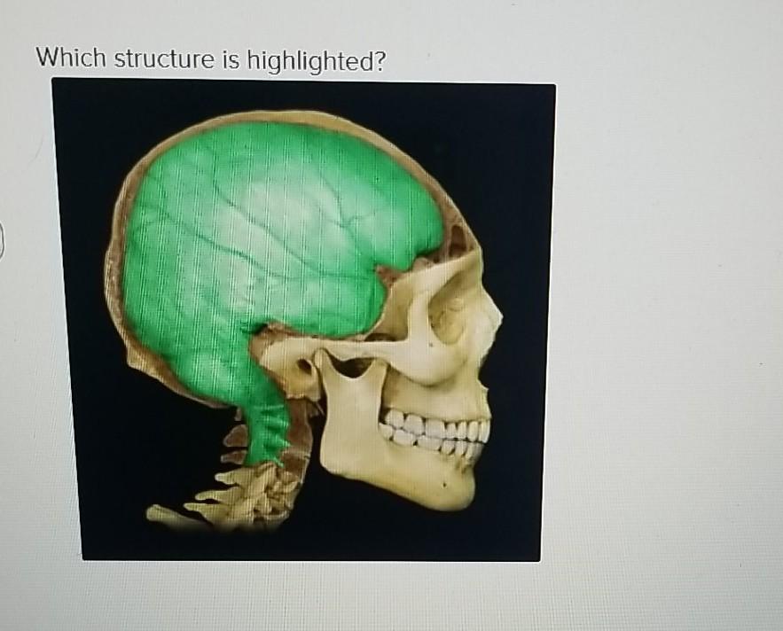 Solved Which structure is highlighted? Multiple Choice pia | Chegg.com