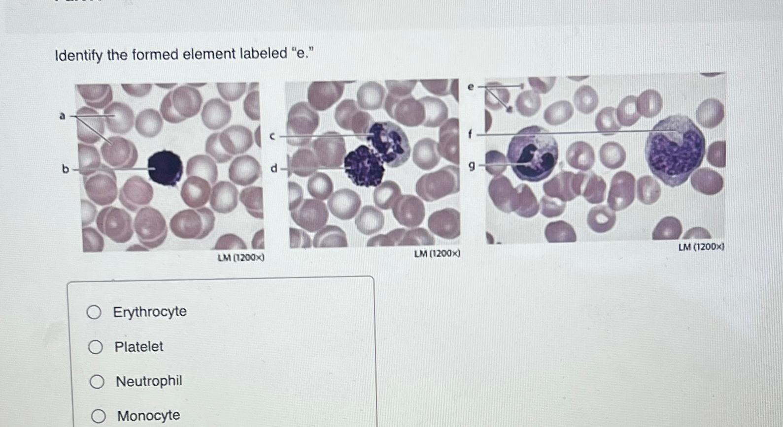 Solved Identify the formed element labeled | Chegg.com