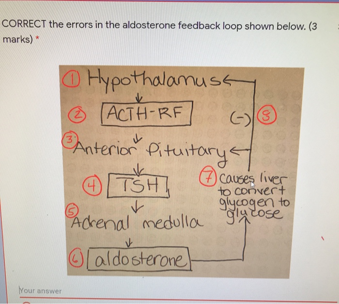 CORRECT the errors in the aldosterone feedback loop | Chegg.com