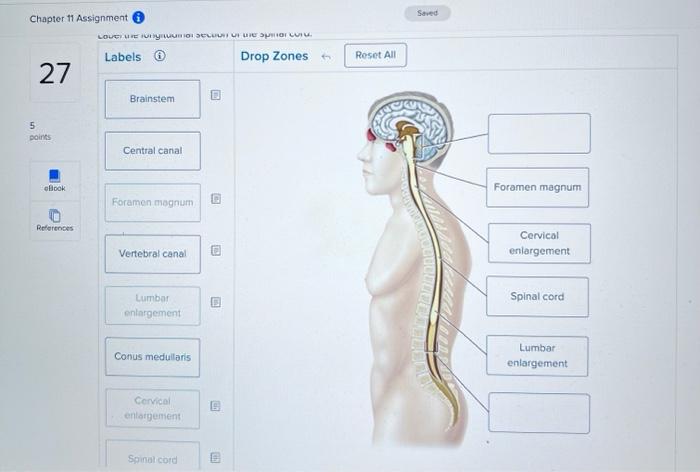 Solved Chapter 11 Assignment i SavedWhat is the function of | Chegg.com