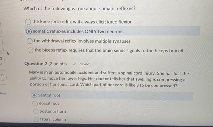 Solved Which of the following is true about somatic | Chegg.com