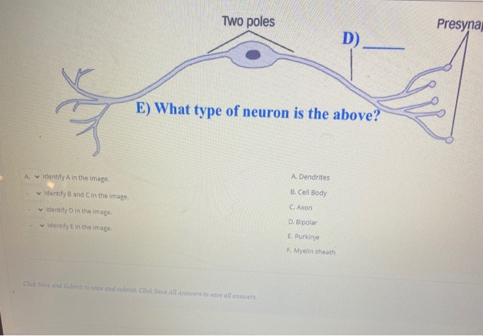 Solved Two poles Presyna D) E) What type of neuron is the | Chegg.com