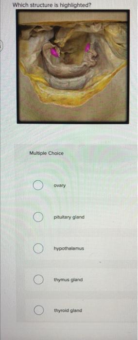 Which structure is highlighted? Multiple Choice ovary | Chegg.com