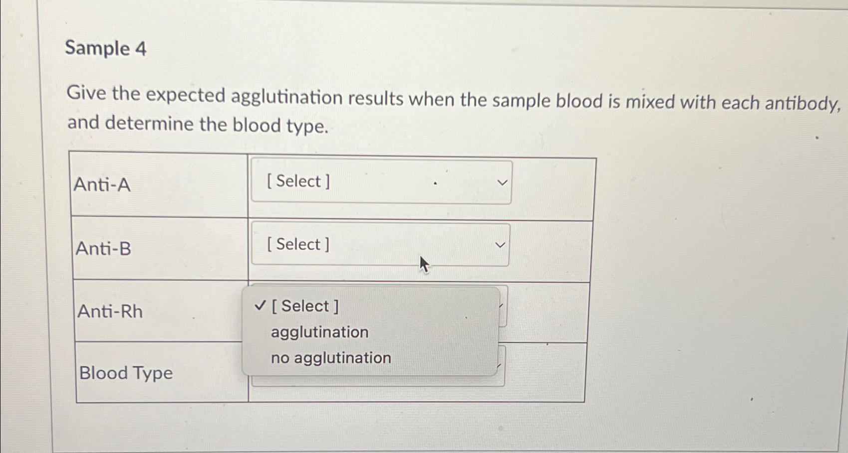 Solved Sample 4Give the expected agglutination results when | Chegg.com