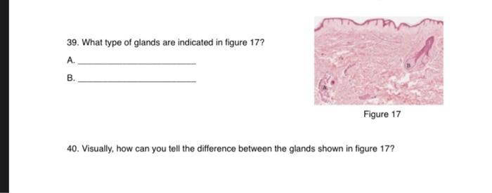 Solved 39. What type of glands are indicated in figure 17? | Chegg.com
