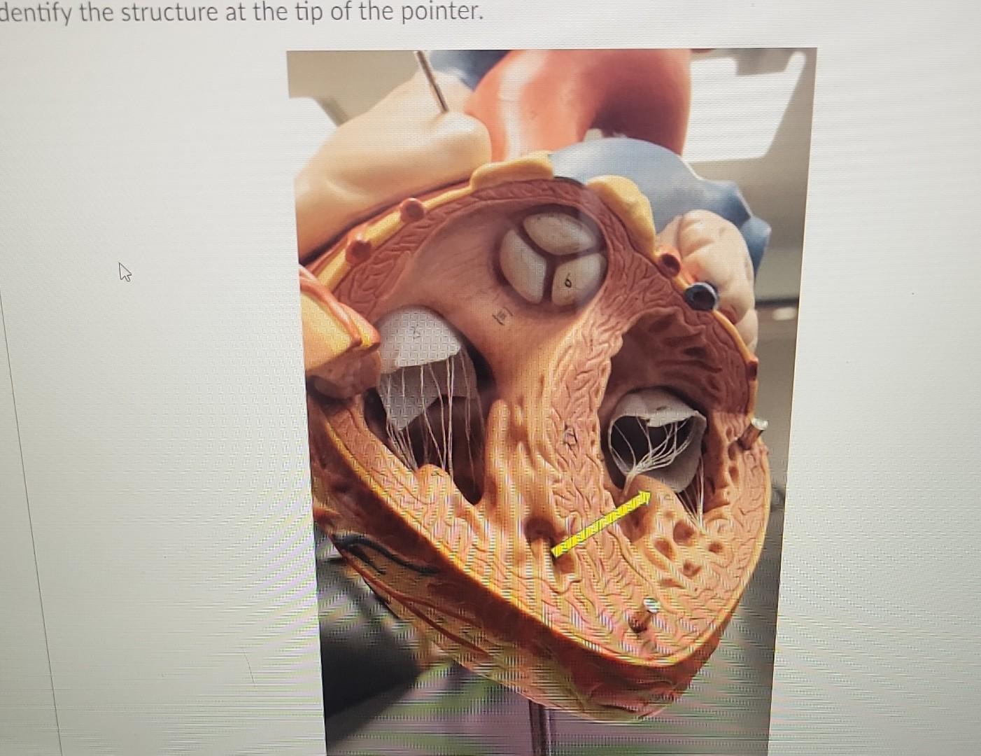 Solved dentify the structure at the tip of the | Chegg.com