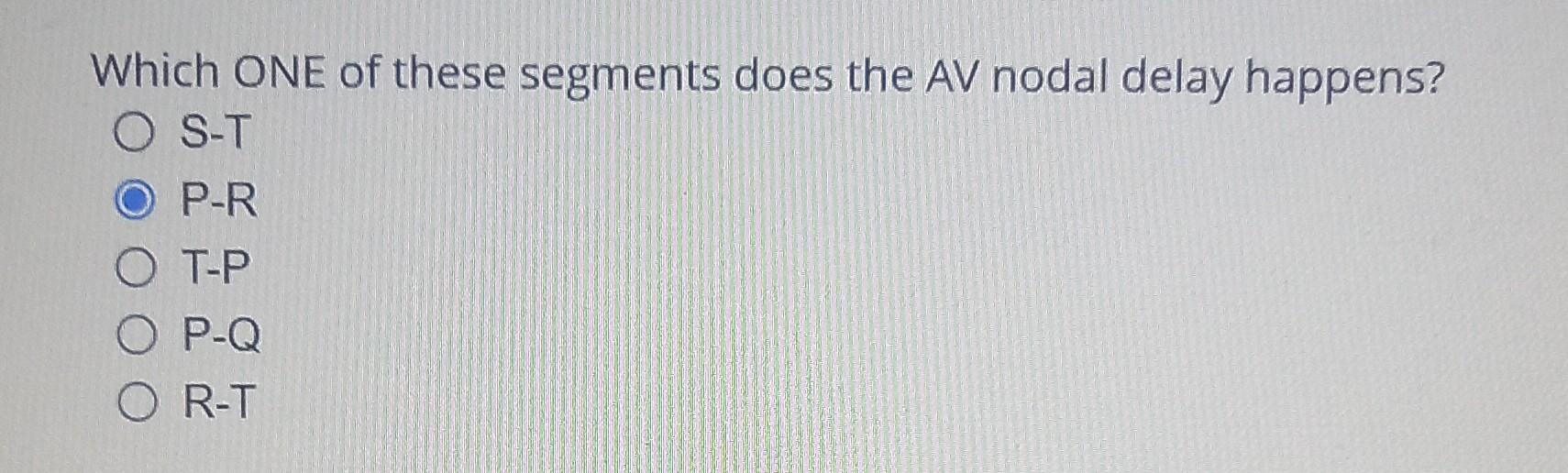 Solved Which ONE of these segments does the AV nodal delay | Chegg.com