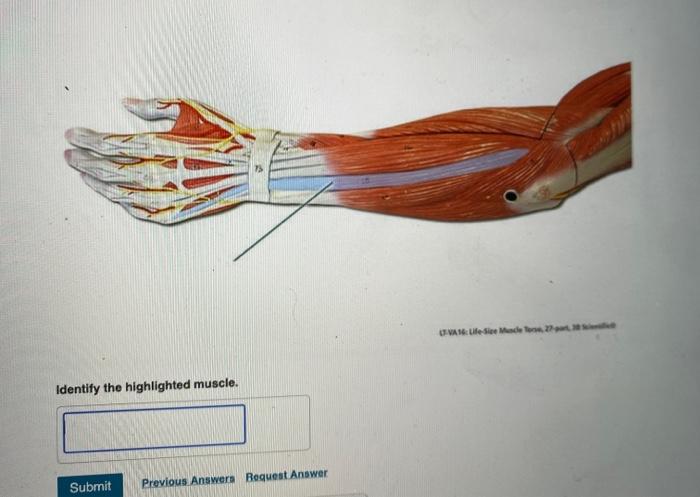 Solved Identify the highlighted muscle. | Chegg.com
