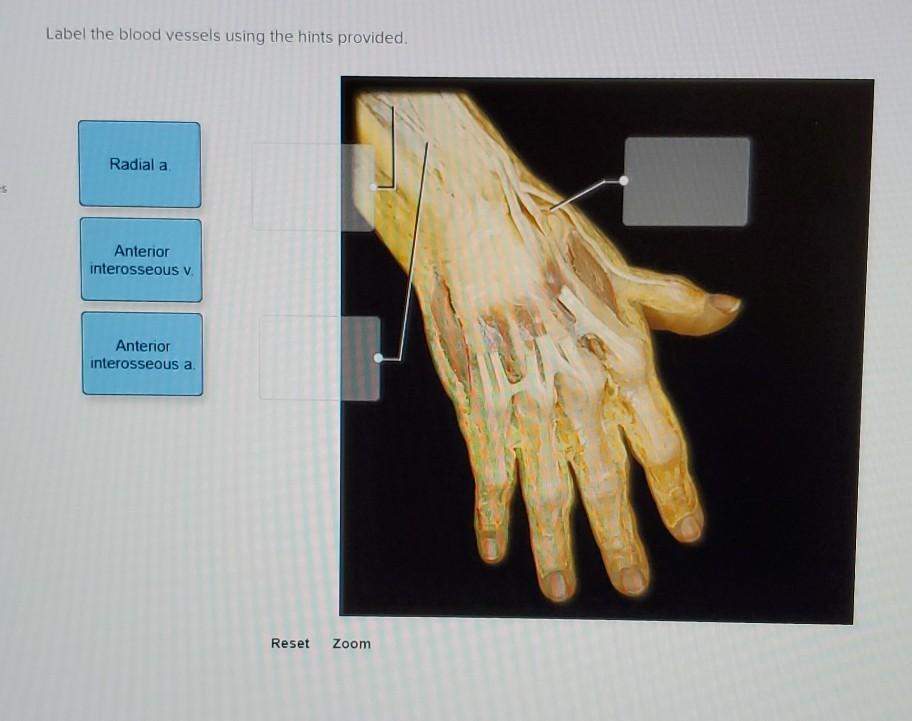 Solved Label the blood vessels using the hints provided. | Chegg.com
