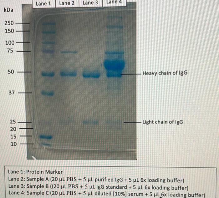 Solved bases on my SDS–PAGE electropherogram, i need help to | Chegg.com