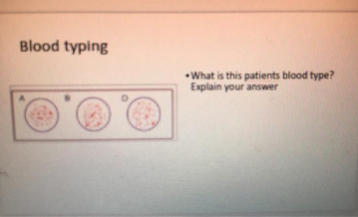 Solved Blood typing • What is this patients blood type? | Chegg.com