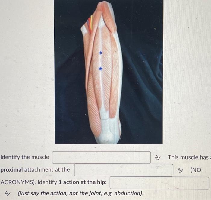 Solved Identify the muscle proximal attachment at the | Chegg.com