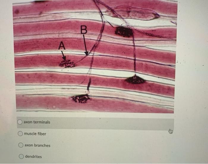 Solved B A axon terminals muscle fiber axon branches | Chegg.com