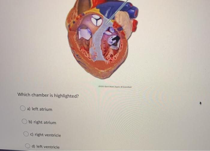 Solved Which chamber is highlighted? a) right ventricle b) | Chegg.com