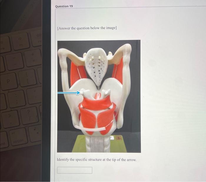 Solved [Answer the question below the image] Identify the | Chegg.com