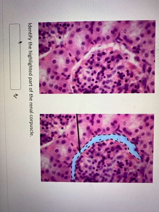Solved Identify the highlighted part of the renal corpuscle. | Chegg.com