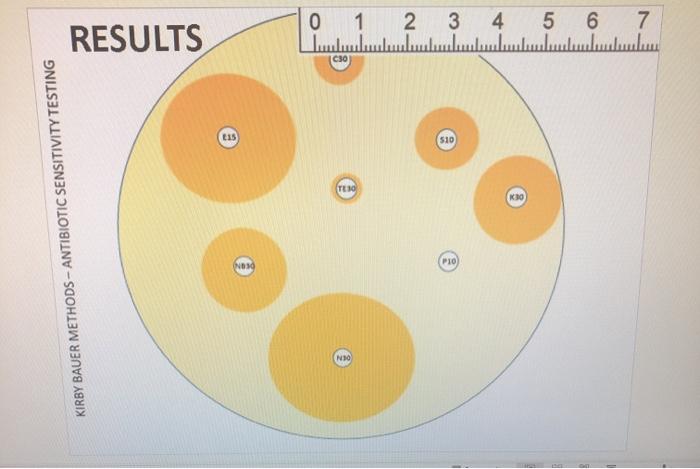 Solved Results: Table 1. Zone Size Interpretation Chart and | Chegg.com