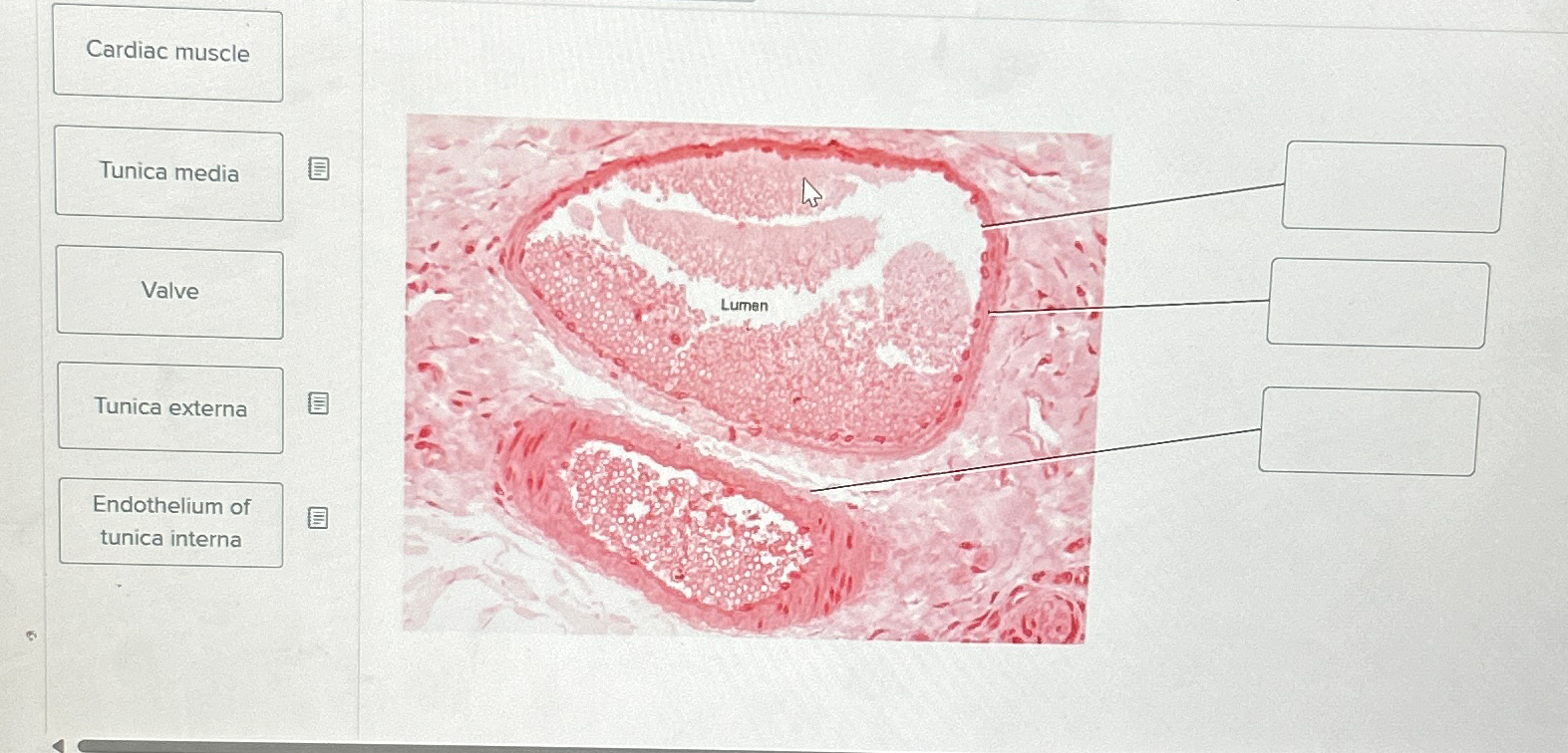 Label the components of the walls of the artery and | Chegg.com