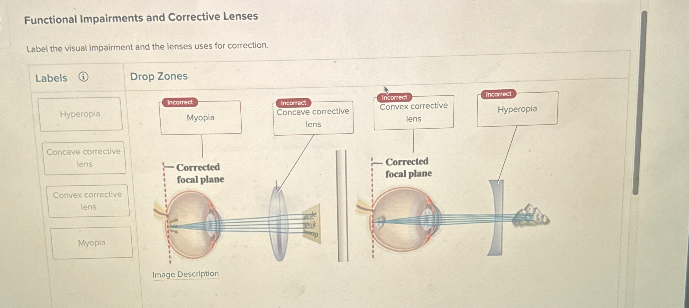 Solved Functional Impairments and Corrective LensesLabel the | Chegg.com