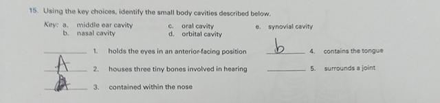 Solved Using the key choices, identify the small body | Chegg.com