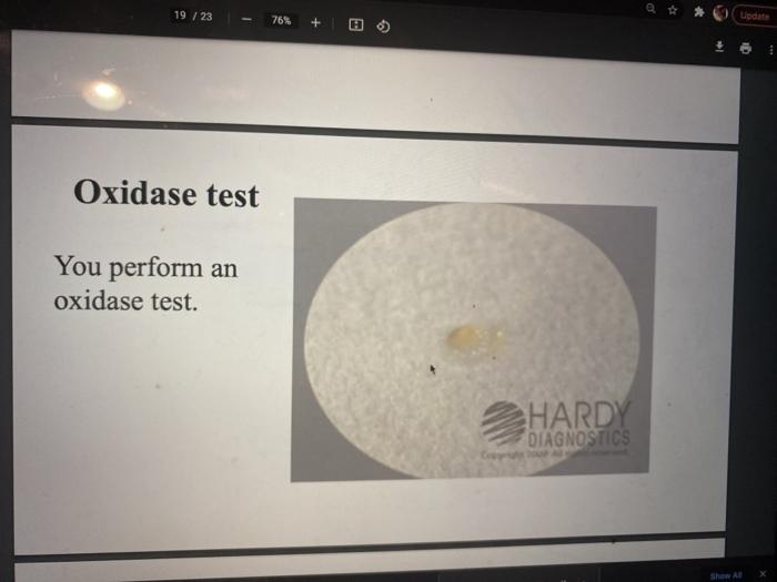 Solved 19 / 23 - Update 76% + Oxidase test You perform an | Chegg.com