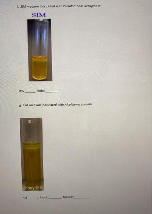 Solved 1. Observe the following SIM media inoculated with | Chegg.com