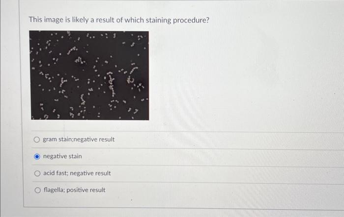 Solved endospore stain; negative capsule; positive acid | Chegg.com