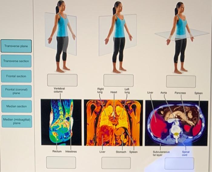 Solved Drag the labels onto the diagram to identify the body | Chegg.com