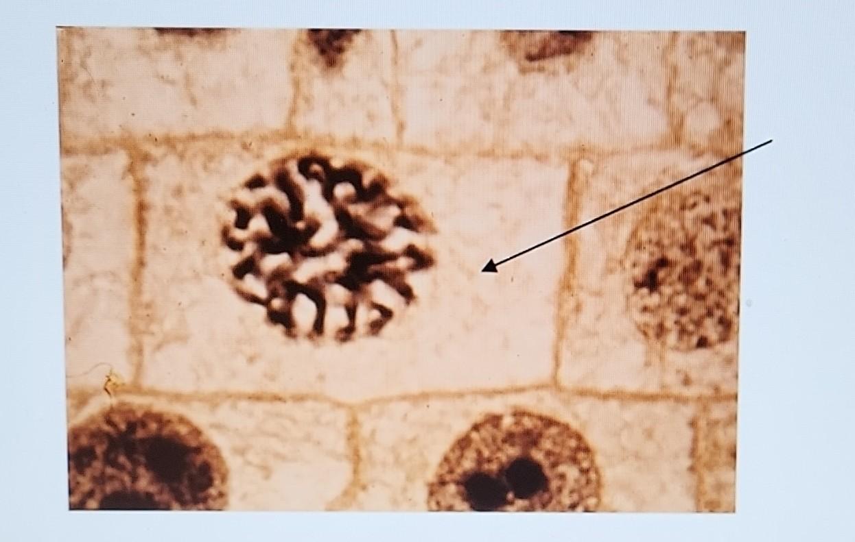 Solved a) Identify the specific phase of mitosis occurring | Chegg.com
