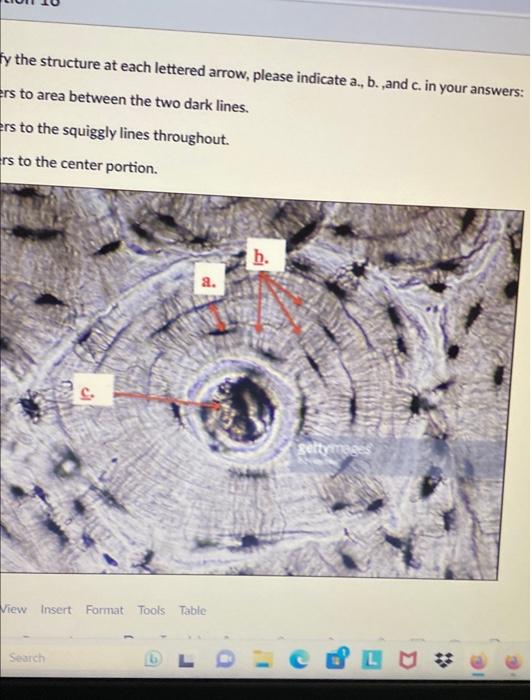 Solved fy the structure at each lettered arrow, please | Chegg.com