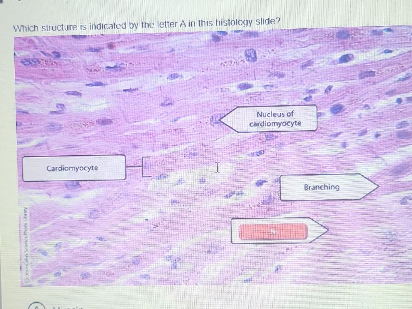 Solved Which structure is indicated by the letter A in this | Chegg.com