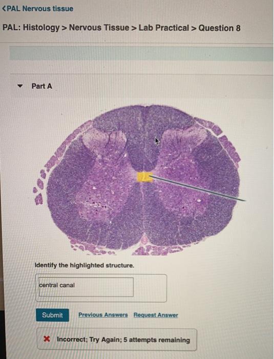 Solved Nervous Tissue > Lab Practical > Question 8 Part A | Chegg.com