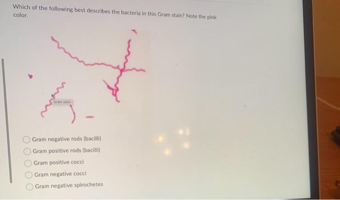 Solved Which of the following best describes the bacteria in | Chegg.com