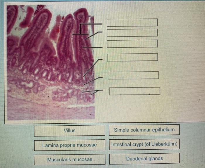 Solved Villus Simple columnar epithelium Lamina propria | Chegg.com