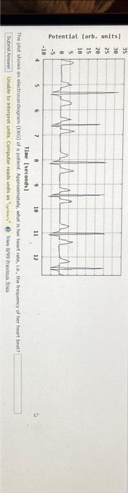 Solved The plot strows an electrocardiogram (EKG) of a | Chegg.com