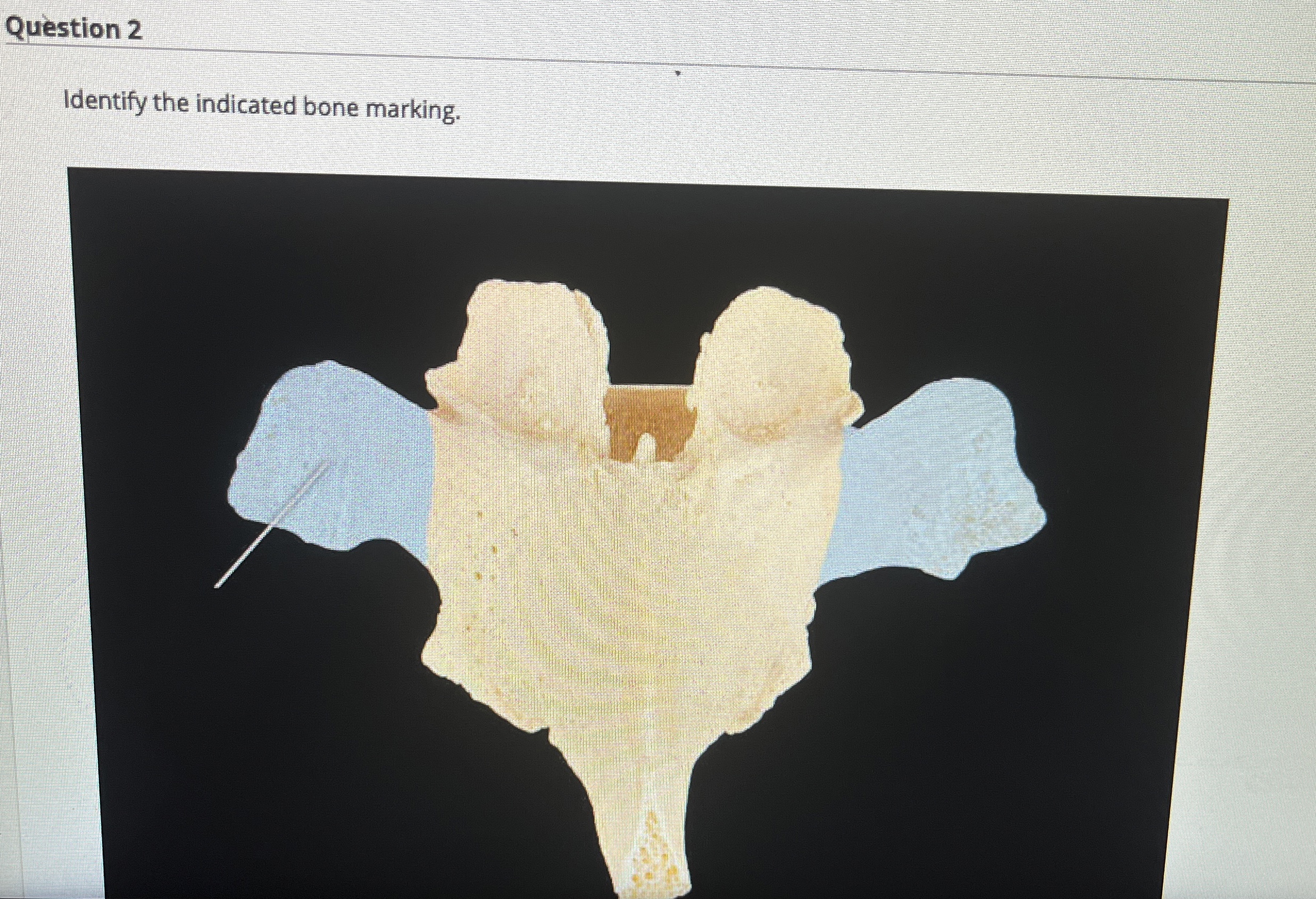 Solved Identify the indicated bone marking.Question | Chegg.com