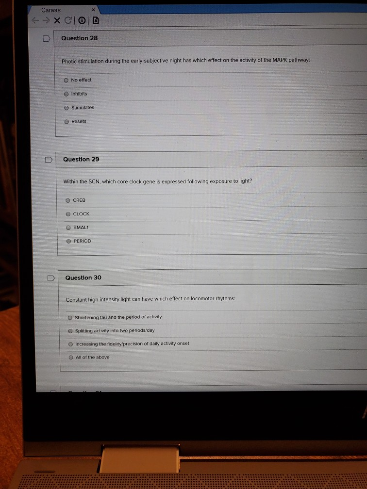 Solved Canvas →XCIO D Question 28 Photic stimulation during | Chegg.com Solved Canvas →XCIO D Question 28 Photic stimulation during | Chegg.com
